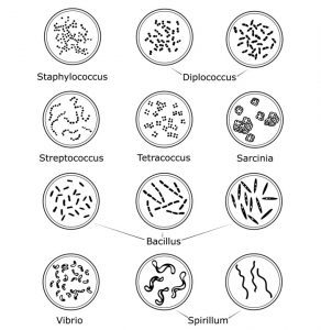 Gram-positive vs Gram-negative - Which is purple? Which is pink / red?